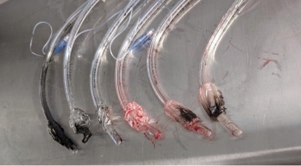 Rare Airway Fires Still Occur With Air- And Saline-Filled Endotracheal ...