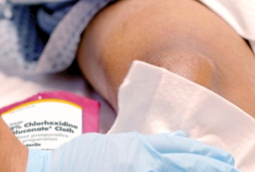 Surgical Site Infection Bundle Improves Patient Outcomes